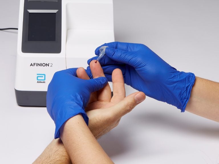 Afinion 2 HbA1c / ACR Analyzer and Test Cartridges | Medline Industries ...